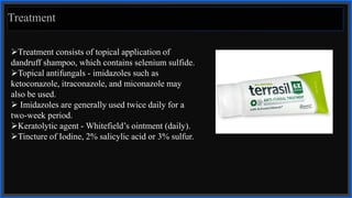 Tinea nigra presentation | PPTX