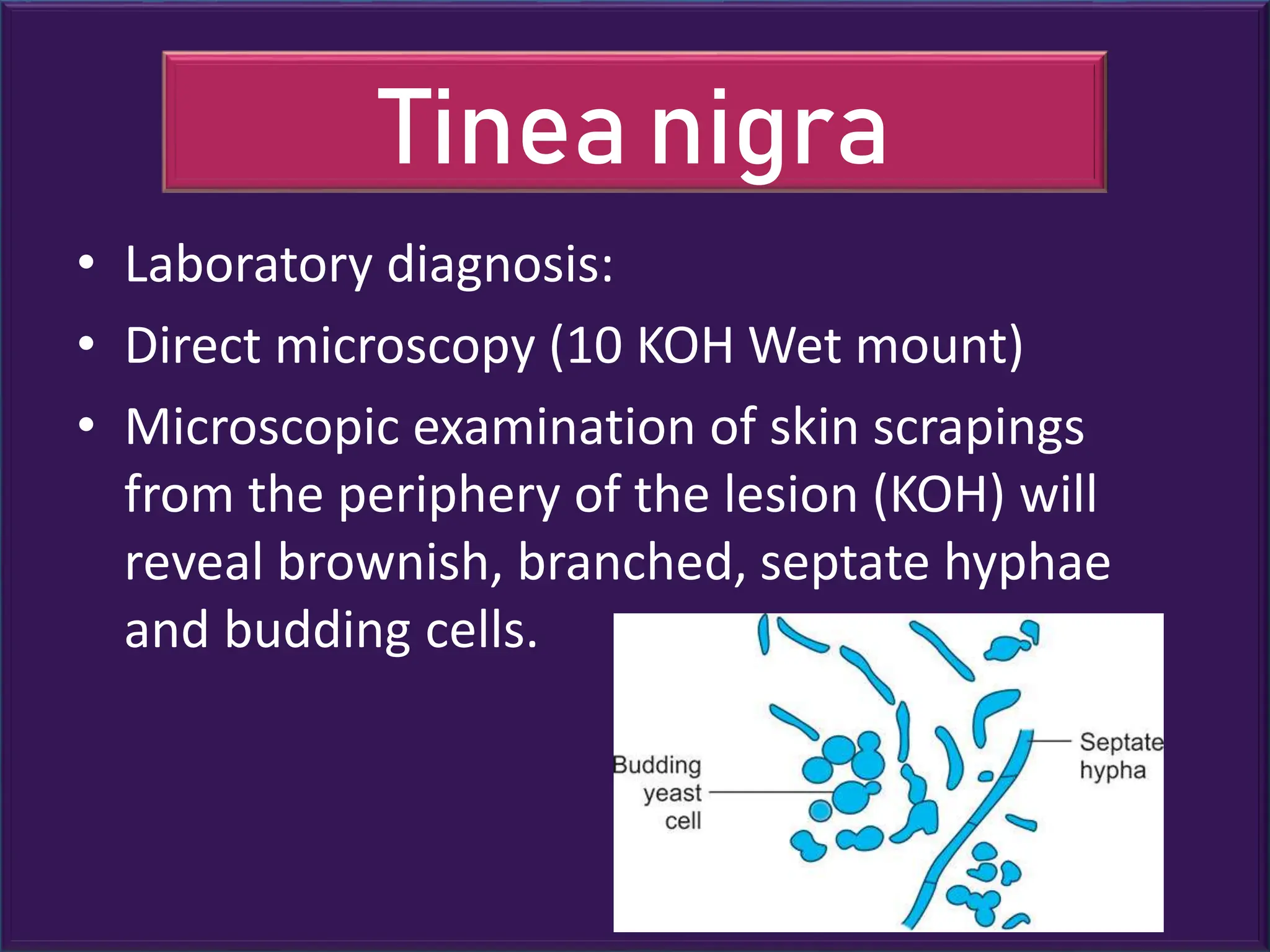 Tinea nigra (Hortaea werneckii)ppt .pptx
