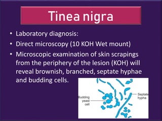 Tinea nigra (Hortaea werneckii)ppt .pptx