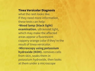 tinea versicolour.pdf