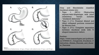 Tinjauan komprehensif Atresia duodenal.pptx