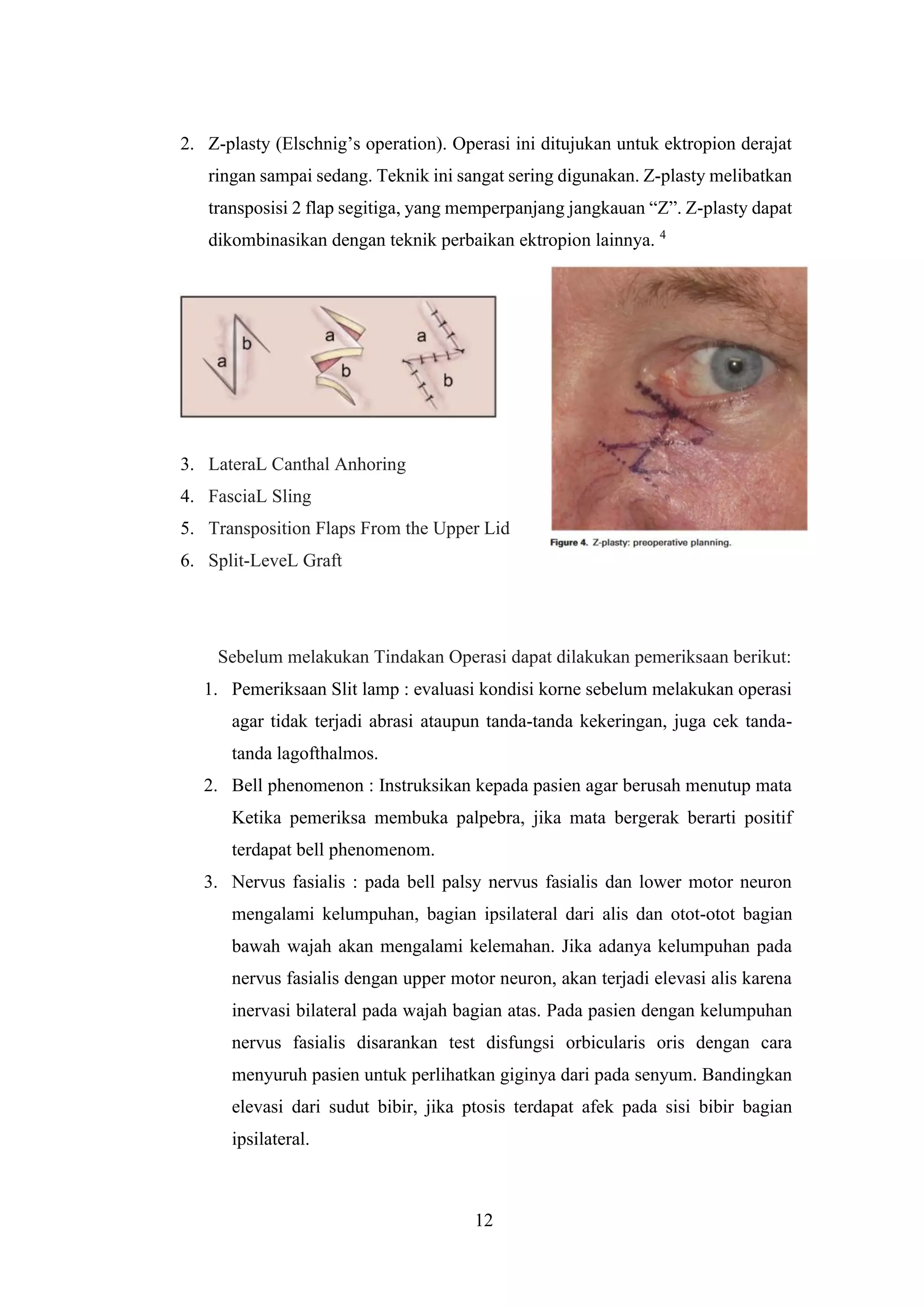 Tinjauan pustaka ektropion sikatrik | PDF