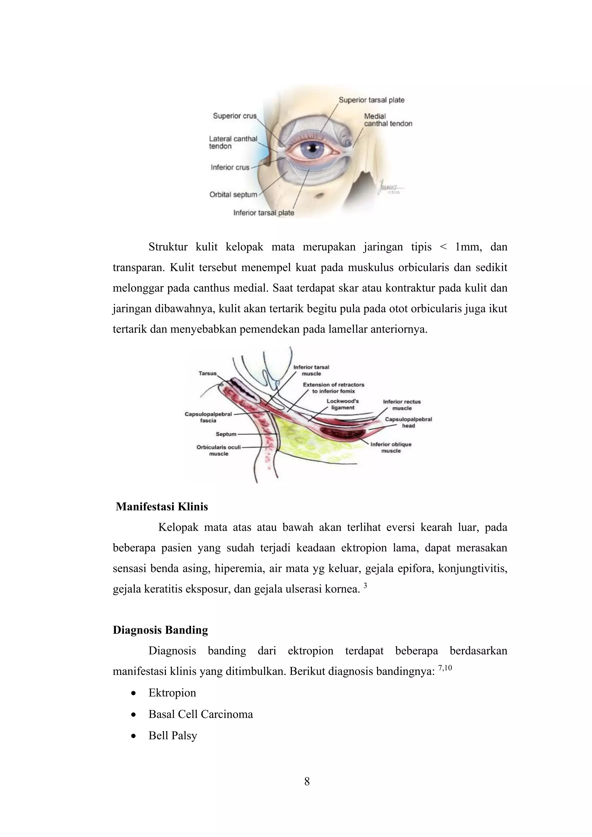 Tinjauan pustaka ektropion sikatrik | PDF