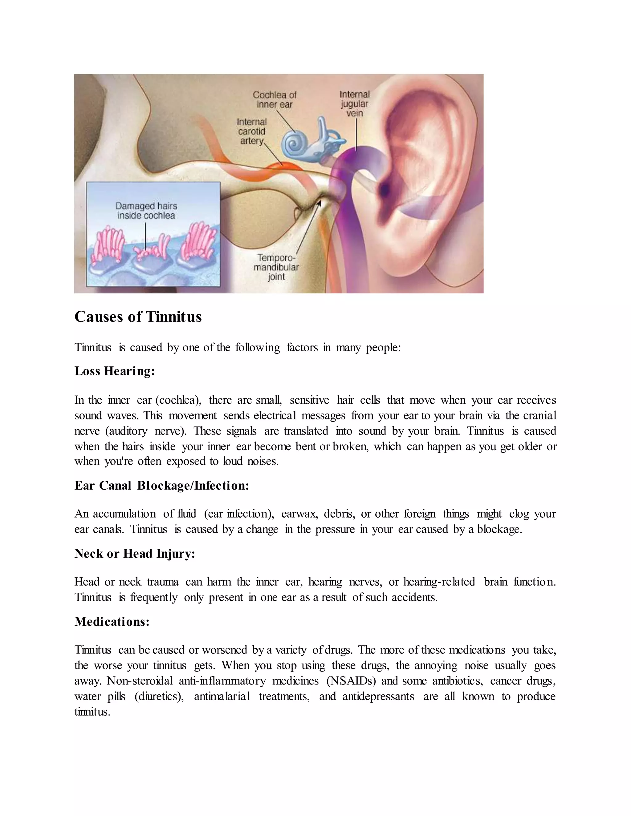 Tinnitus causes and symptoms | DOCX