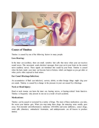 Tinnitus causes and symptoms | DOCX