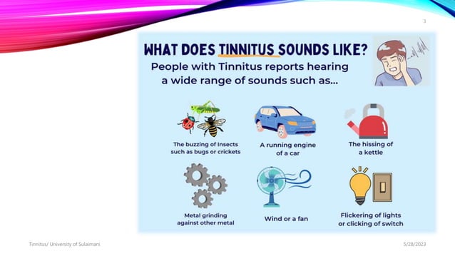 Tinnitus.ppt
