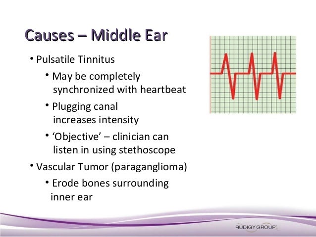Audiology & Hearing Health - Tinnitus Presentation