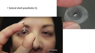 Tinted Contact lenses.pptx