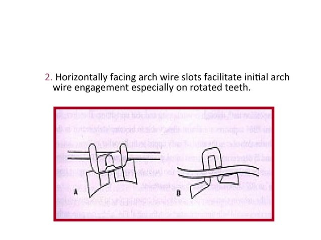 Tip-Edge Orthodontic Appliance System ORTHODONTICS | PPT