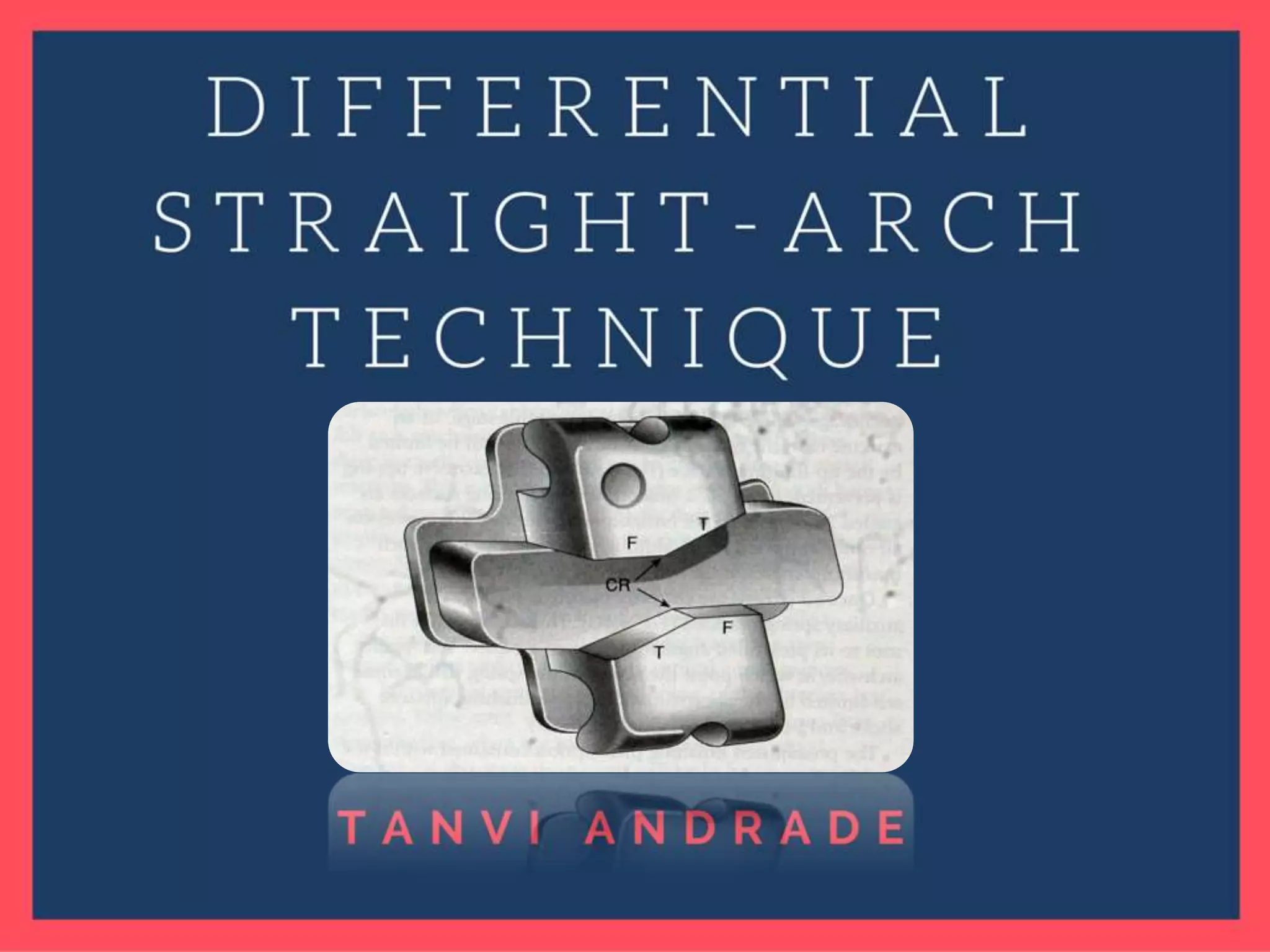 Tip edge appliance | PPTX