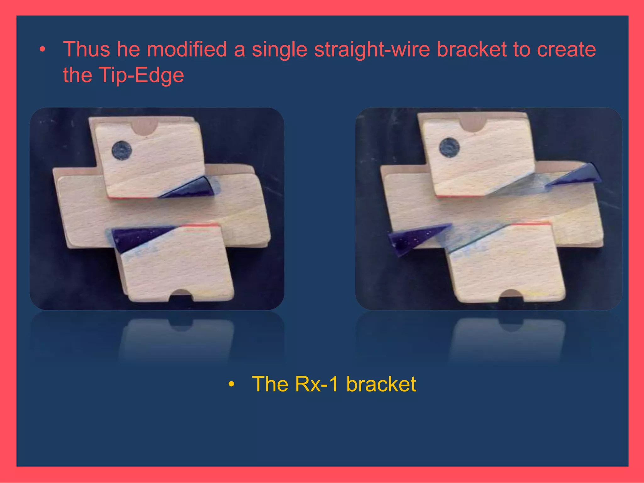 Tip edge appliance | PPTX