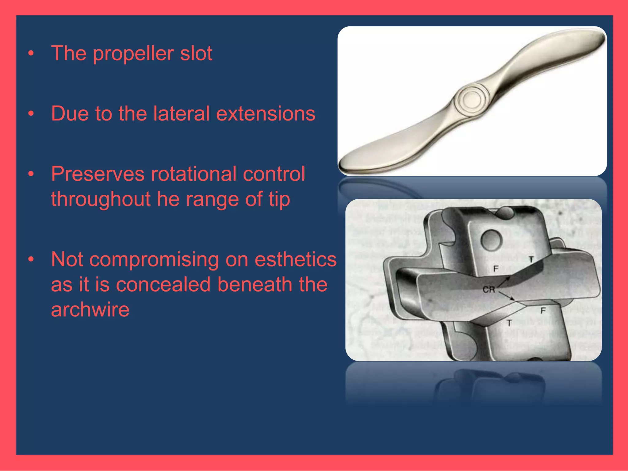 Tip edge appliance | PPTX