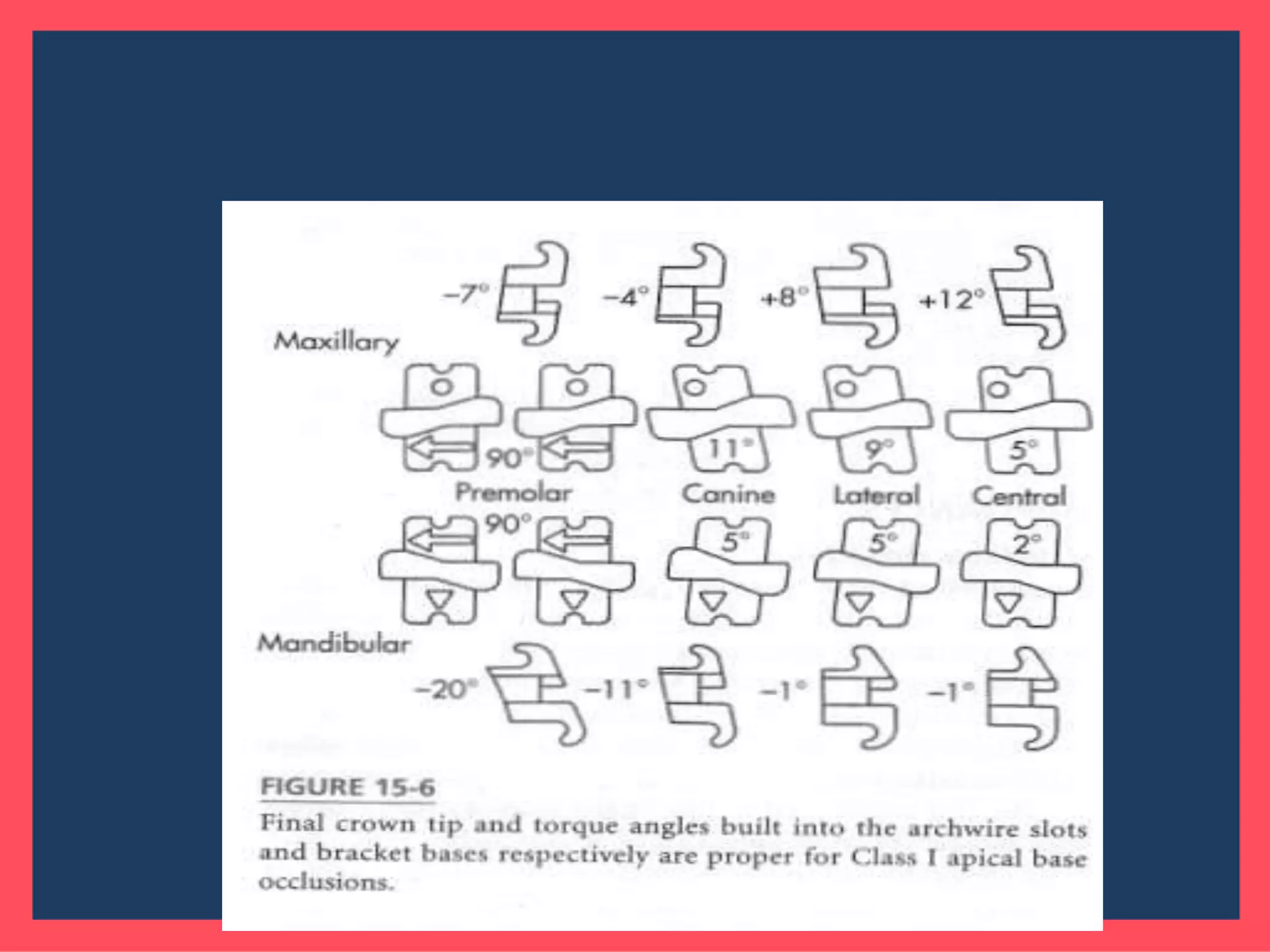 Tip edge appliance | PPTX