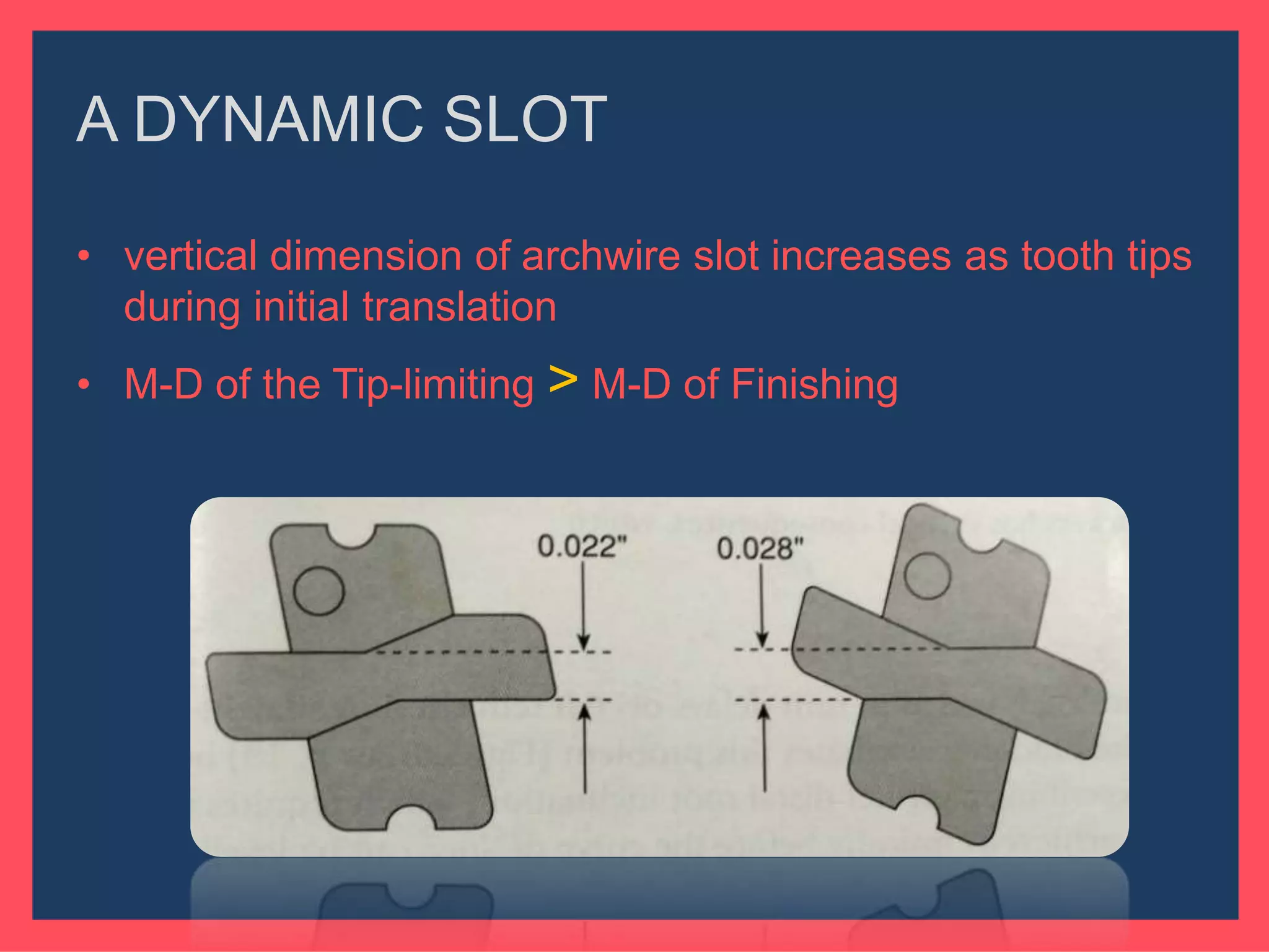 Tip edge appliance | PPTX