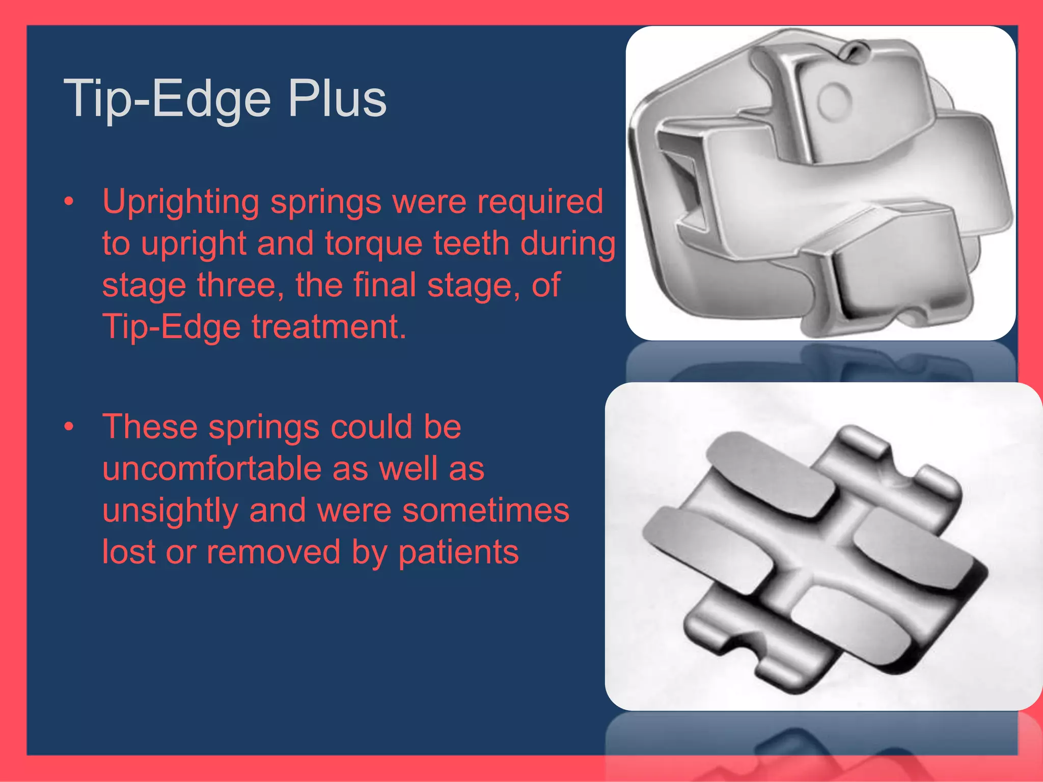 Tip edge appliance | PPTX