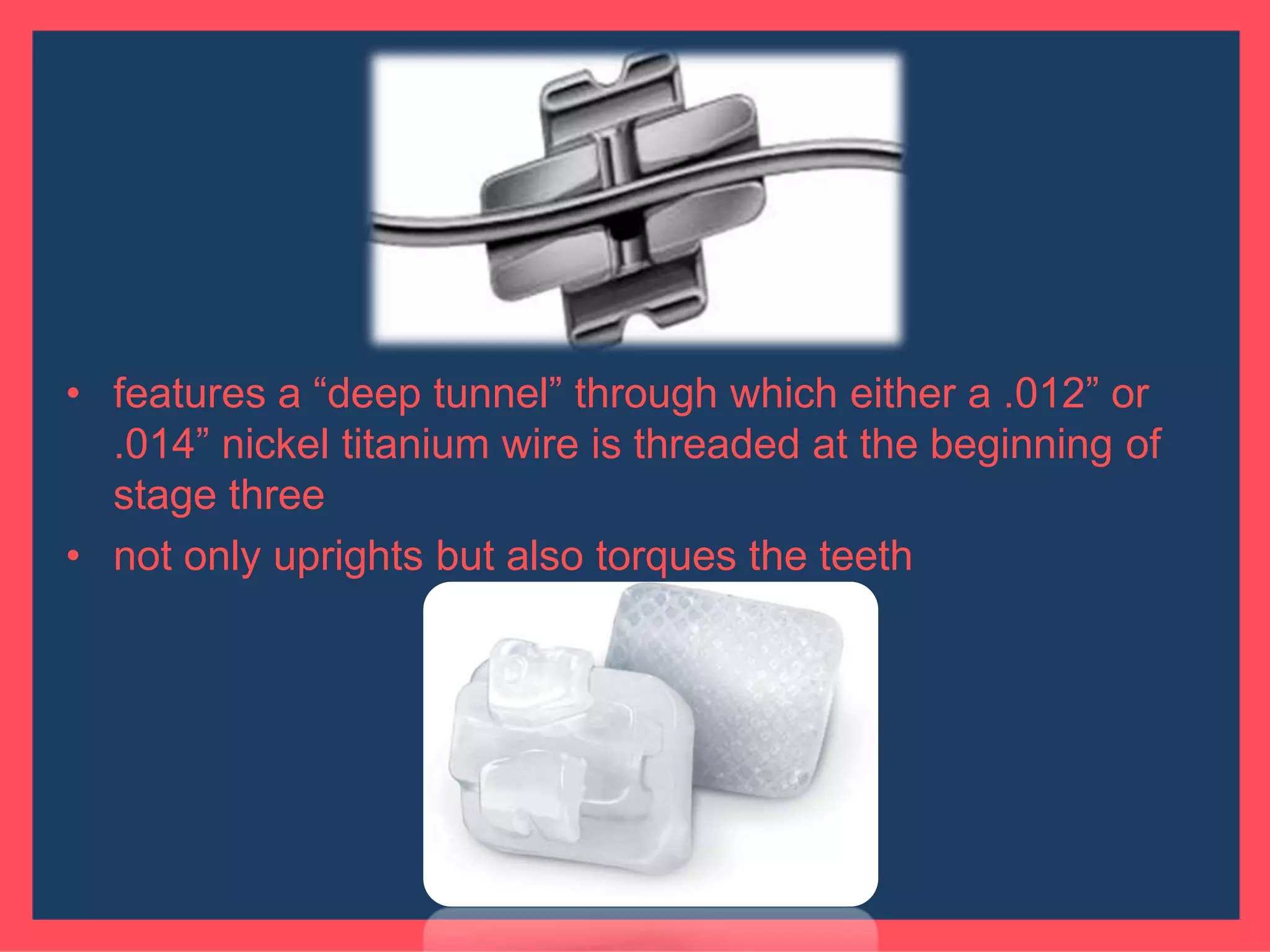 Tip edge appliance | PPTX