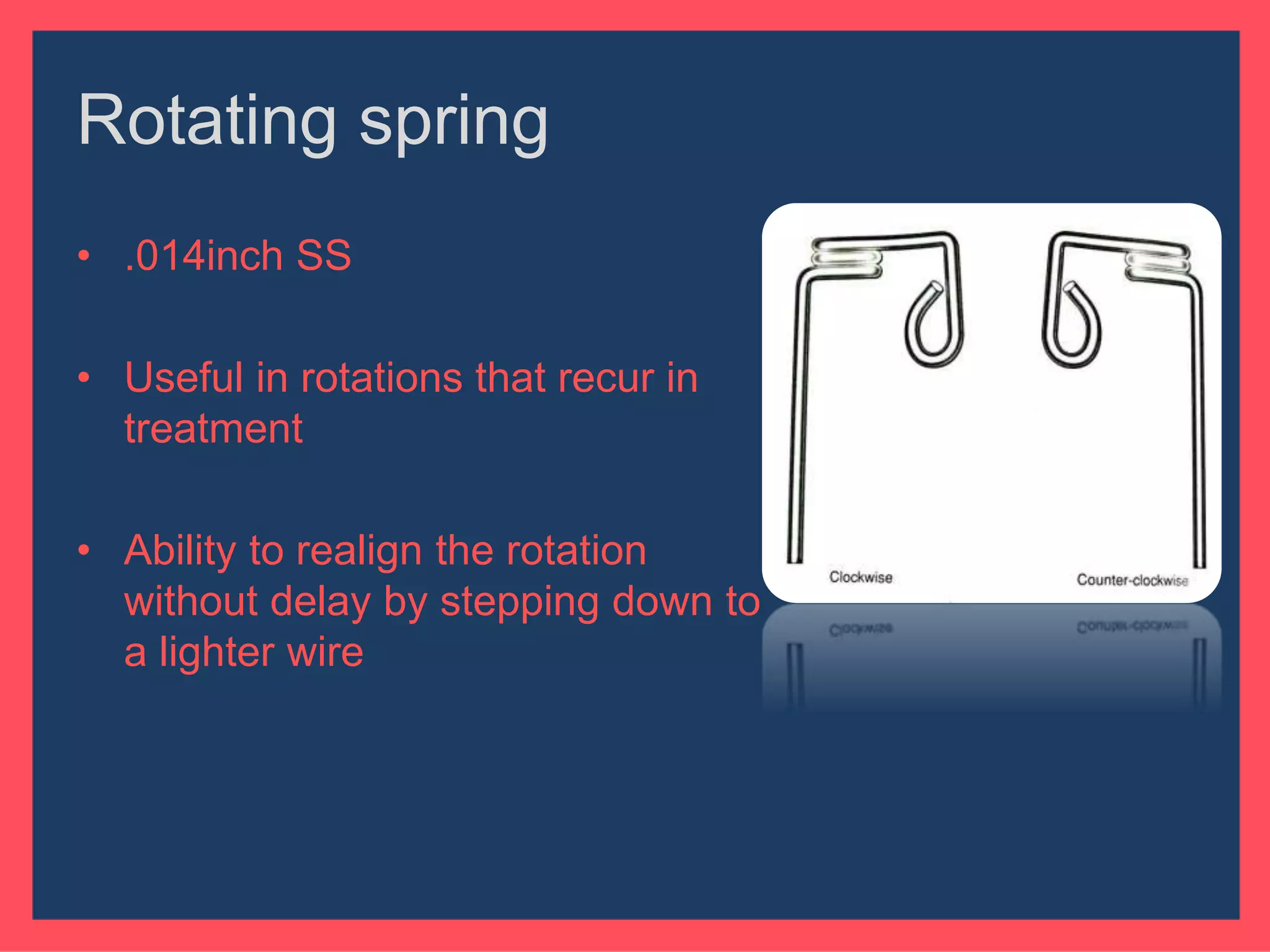 Tip edge appliance | PPTX