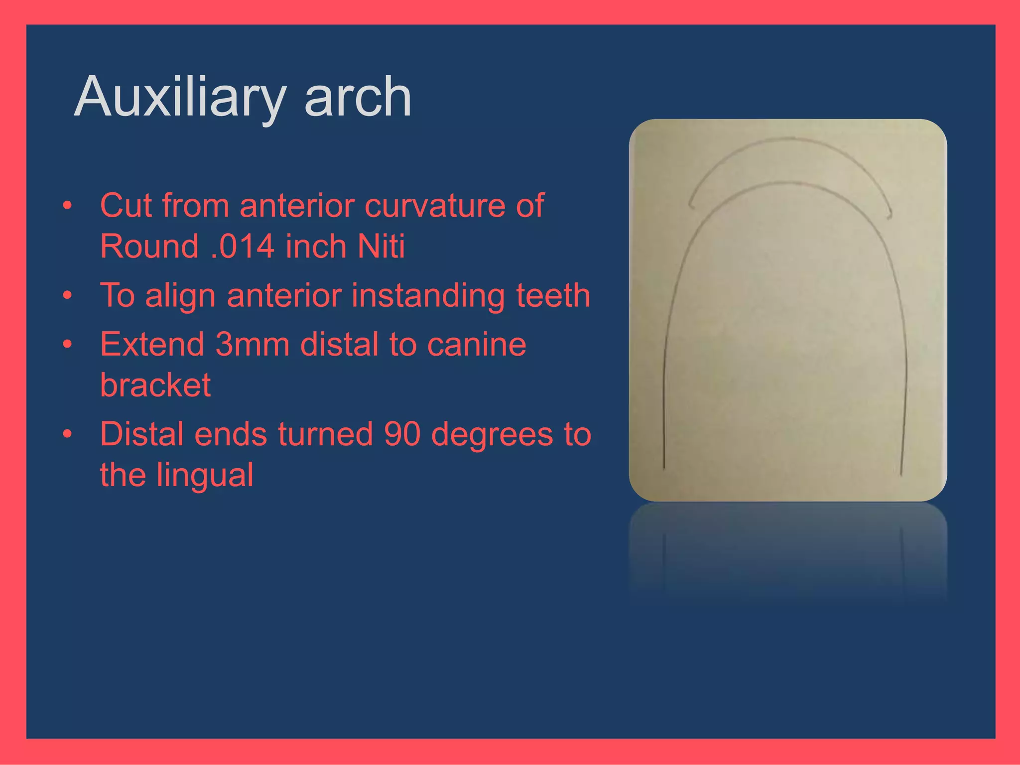 Tip edge appliance | PPTX