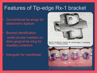 Tip edge appliance | PPTX