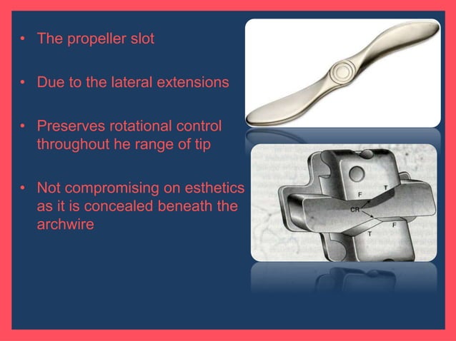 Tip edge appliance | PPTX