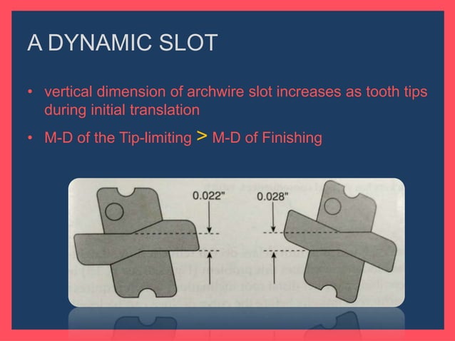 Tip edge appliance | PPTX