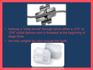 Tip edge appliance | PPTX