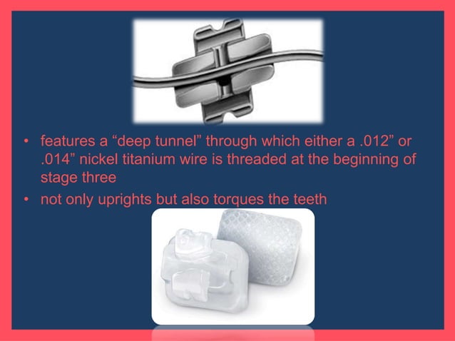 Tip edge appliance | PPTX