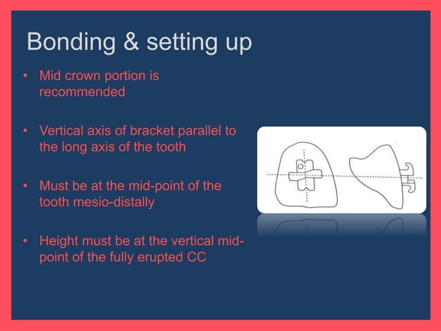 Tip edge appliance | PPTX