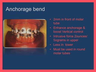 Tip edge appliance | PPTX