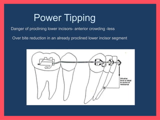 Tip edge appliance | PPTX