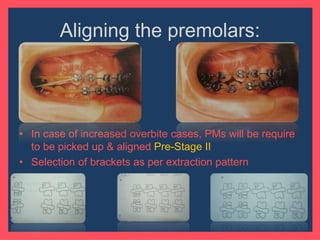 Tip edge appliance | PPTX