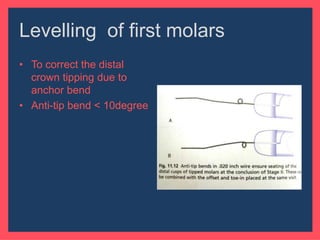 Tip edge appliance | PPTX