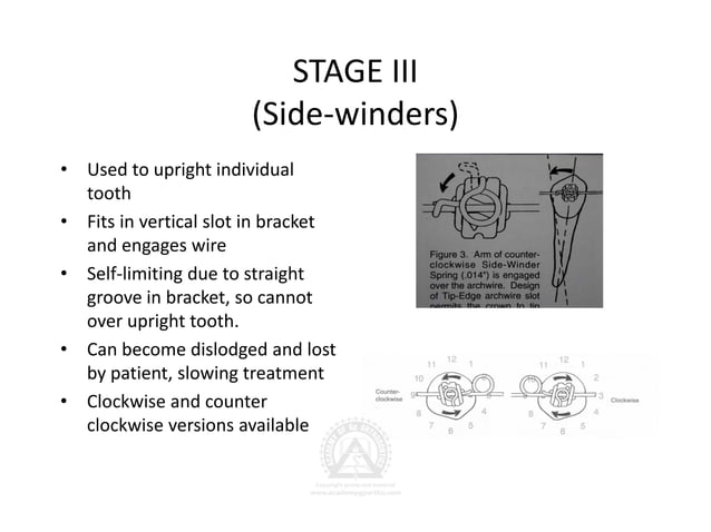 TIP-EDGE TREATMENT STAGES pdfORTHODONTICS | PPT