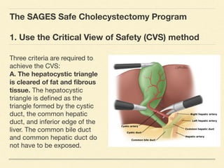 Laparoscopic Cholecystectomy Critical View