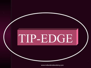 Tipedge | PPT