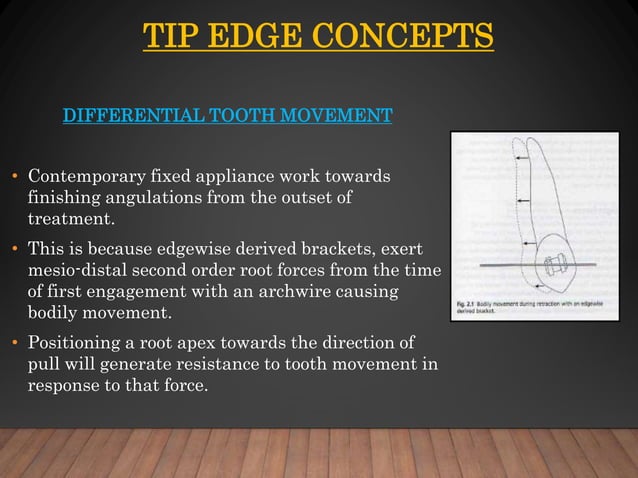 tip edge.pptx | Dental Health | Diseases and Conditions