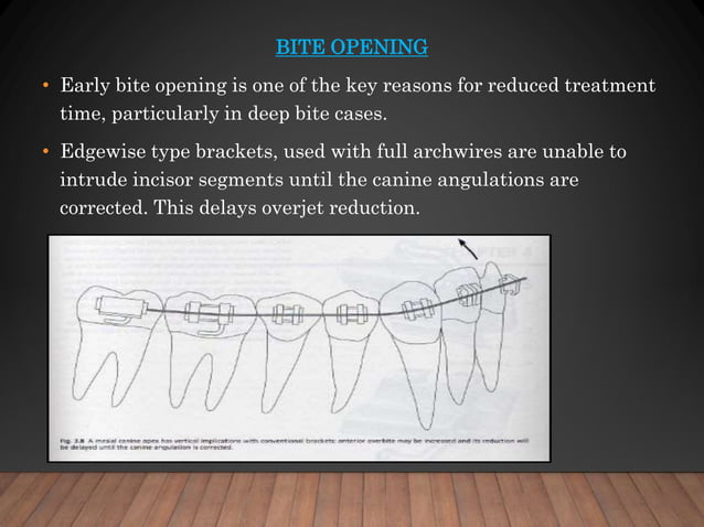 tip edge.pptx | Dental Health | Diseases and Conditions