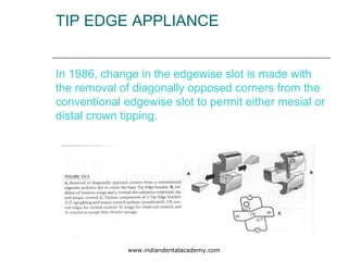Tip edge applaince | PPT