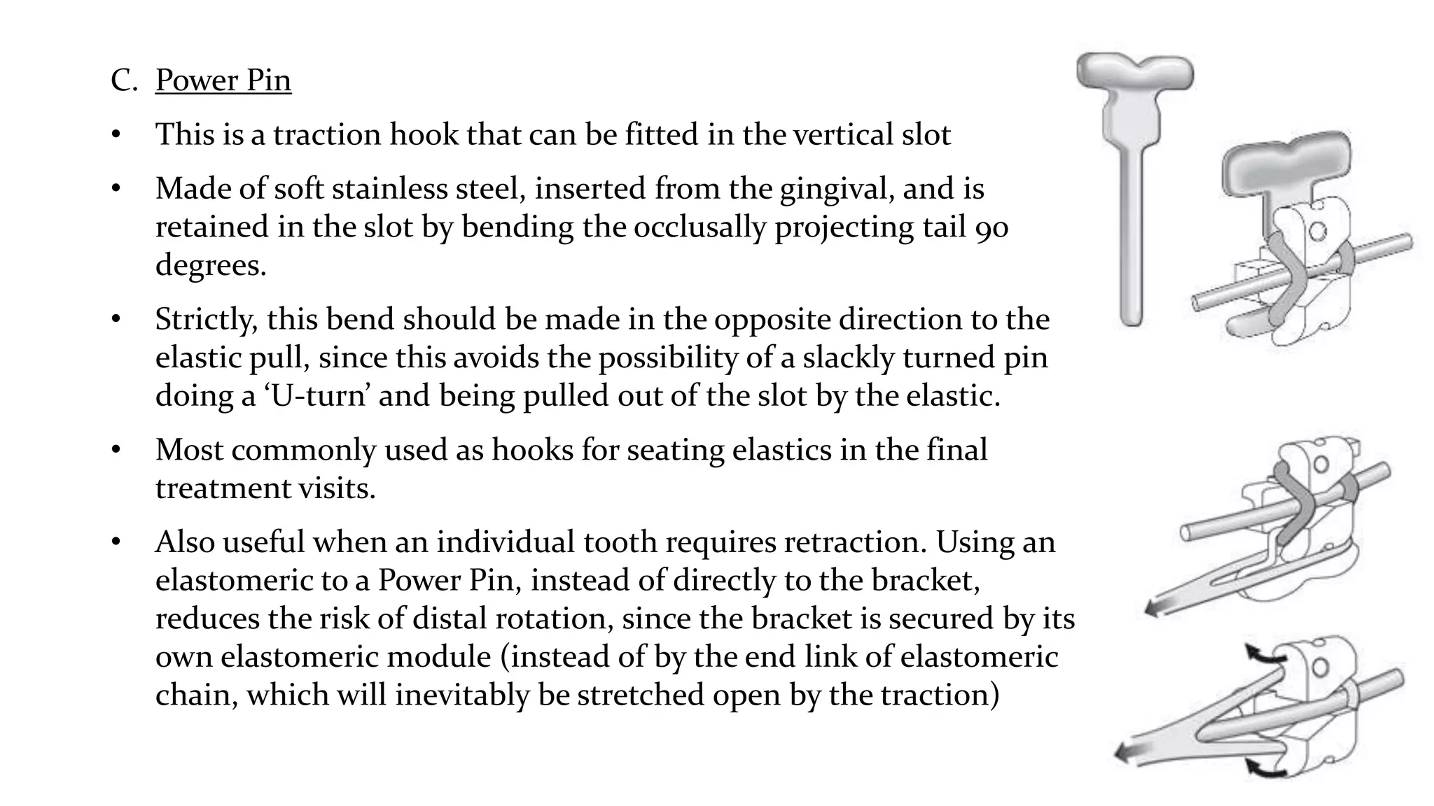 Tip edge mechanics | PPTX