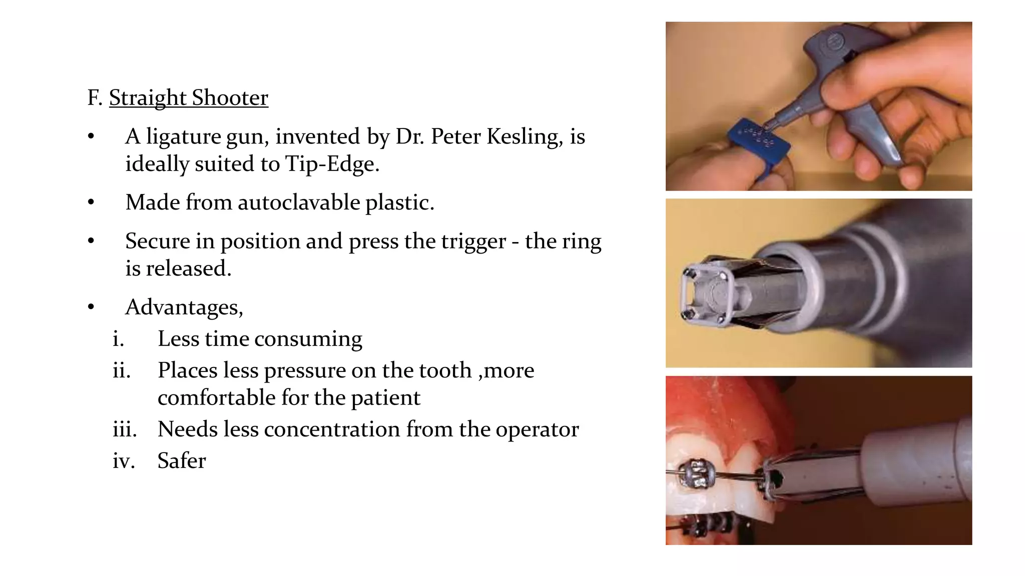 Tip edge mechanics | PPTX