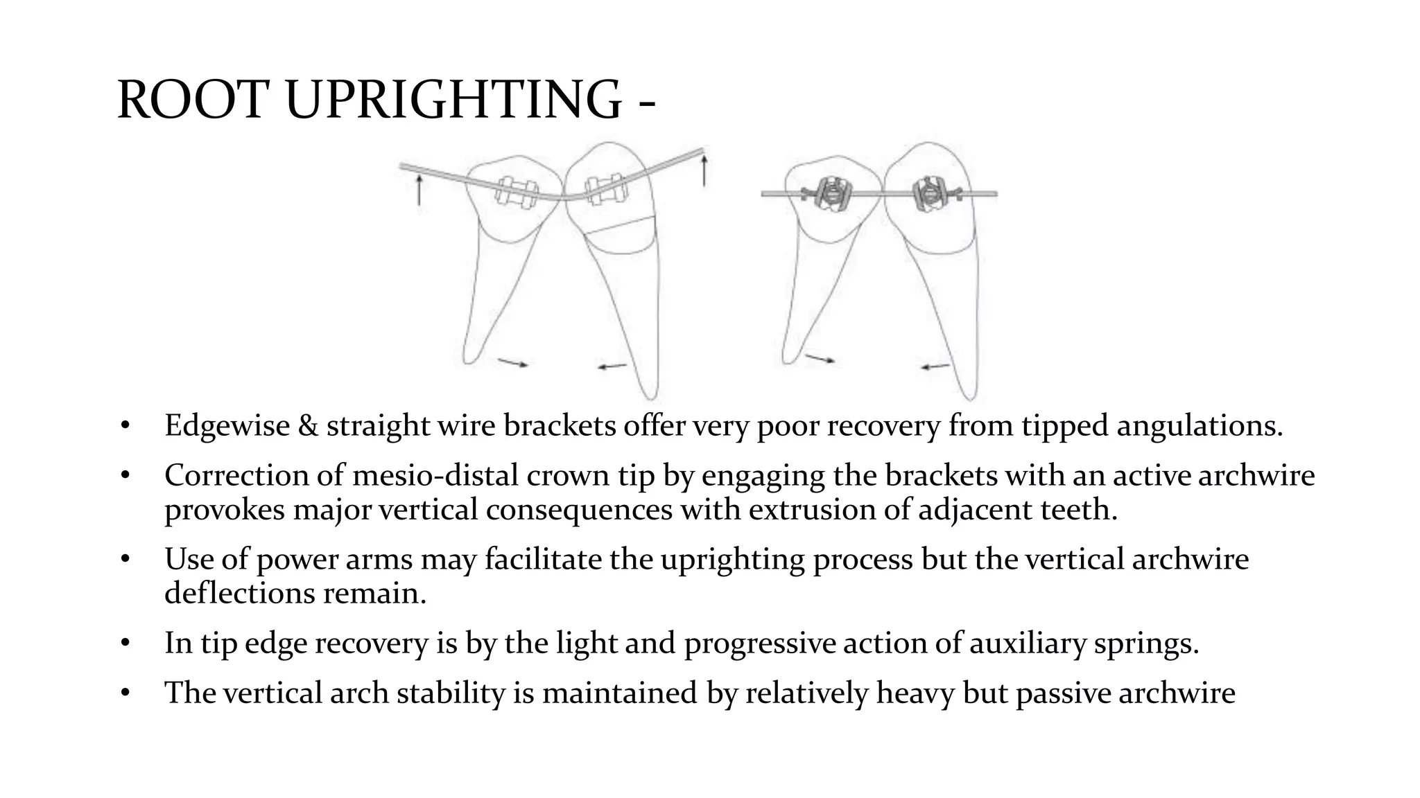 Tip edge mechanics | PPTX