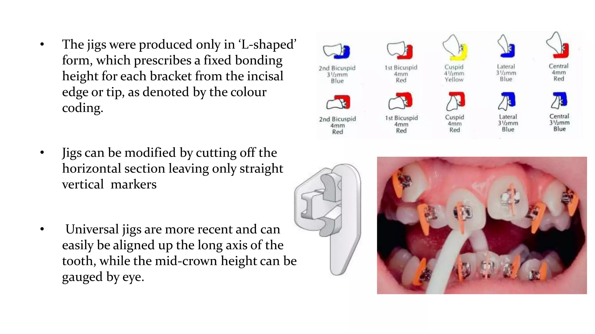 Tip edge mechanics | PPTX