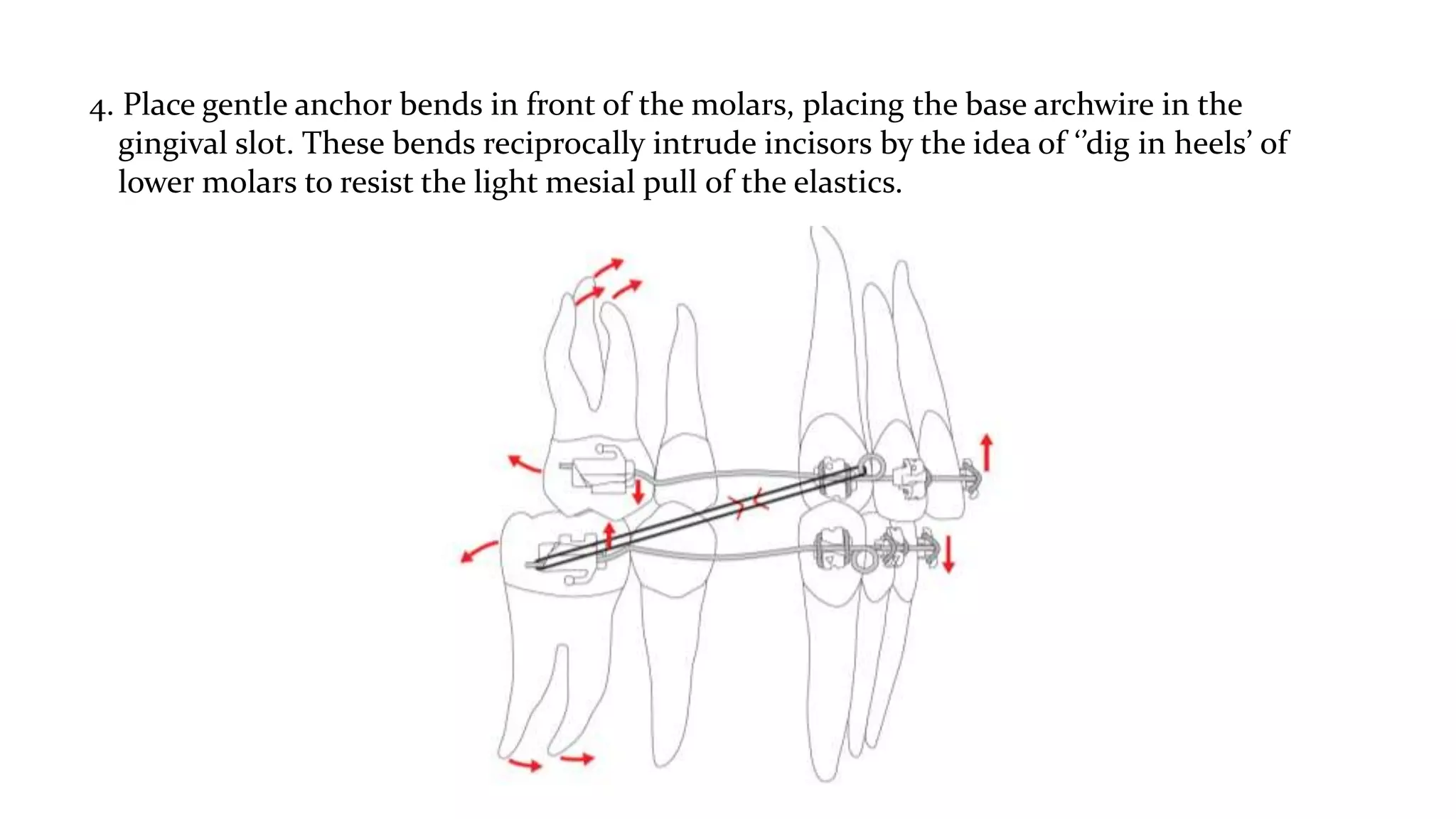 Tip edge mechanics | PPTX