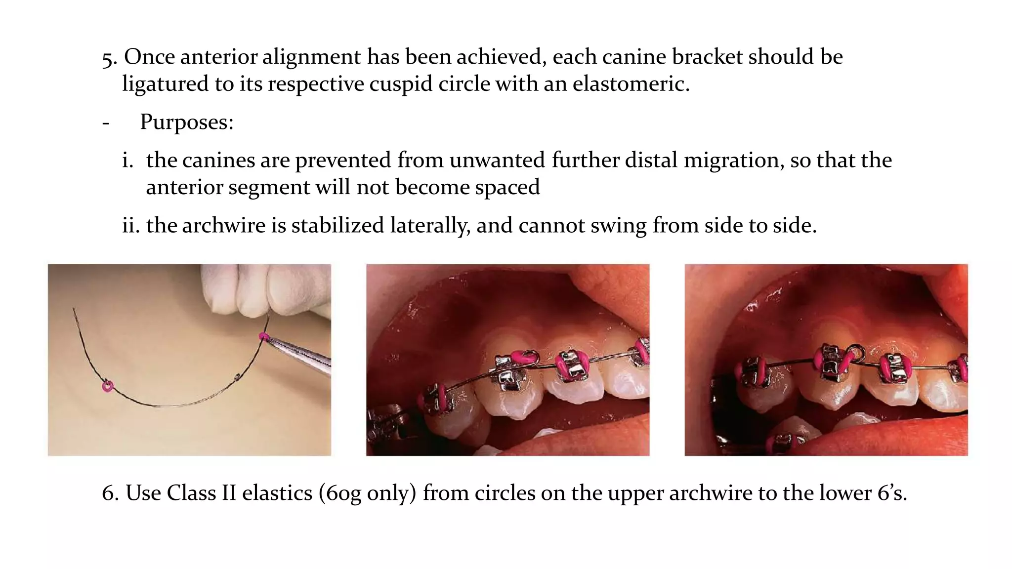 Tip edge mechanics | PPTX