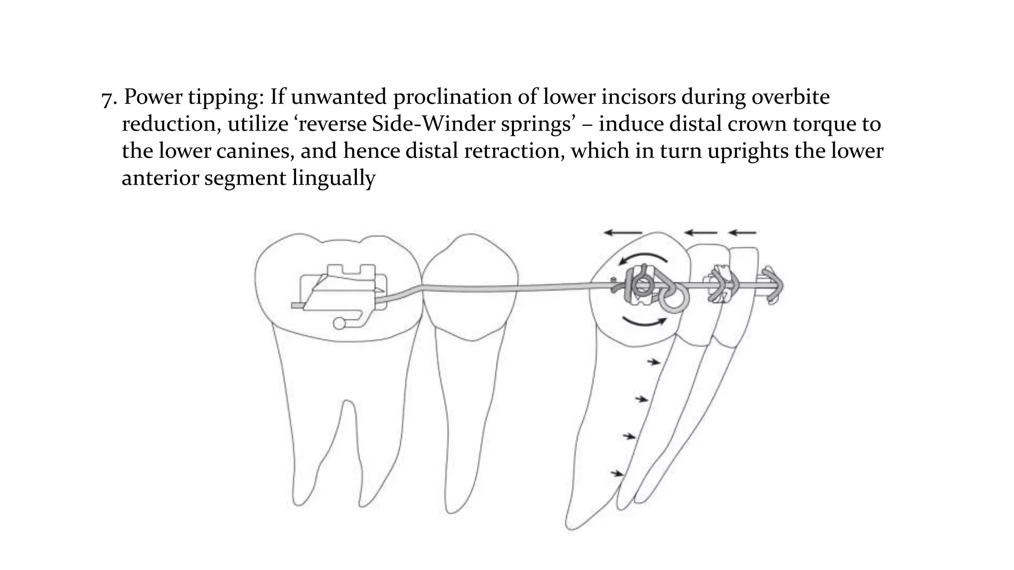 Tip edge mechanics | PPTX