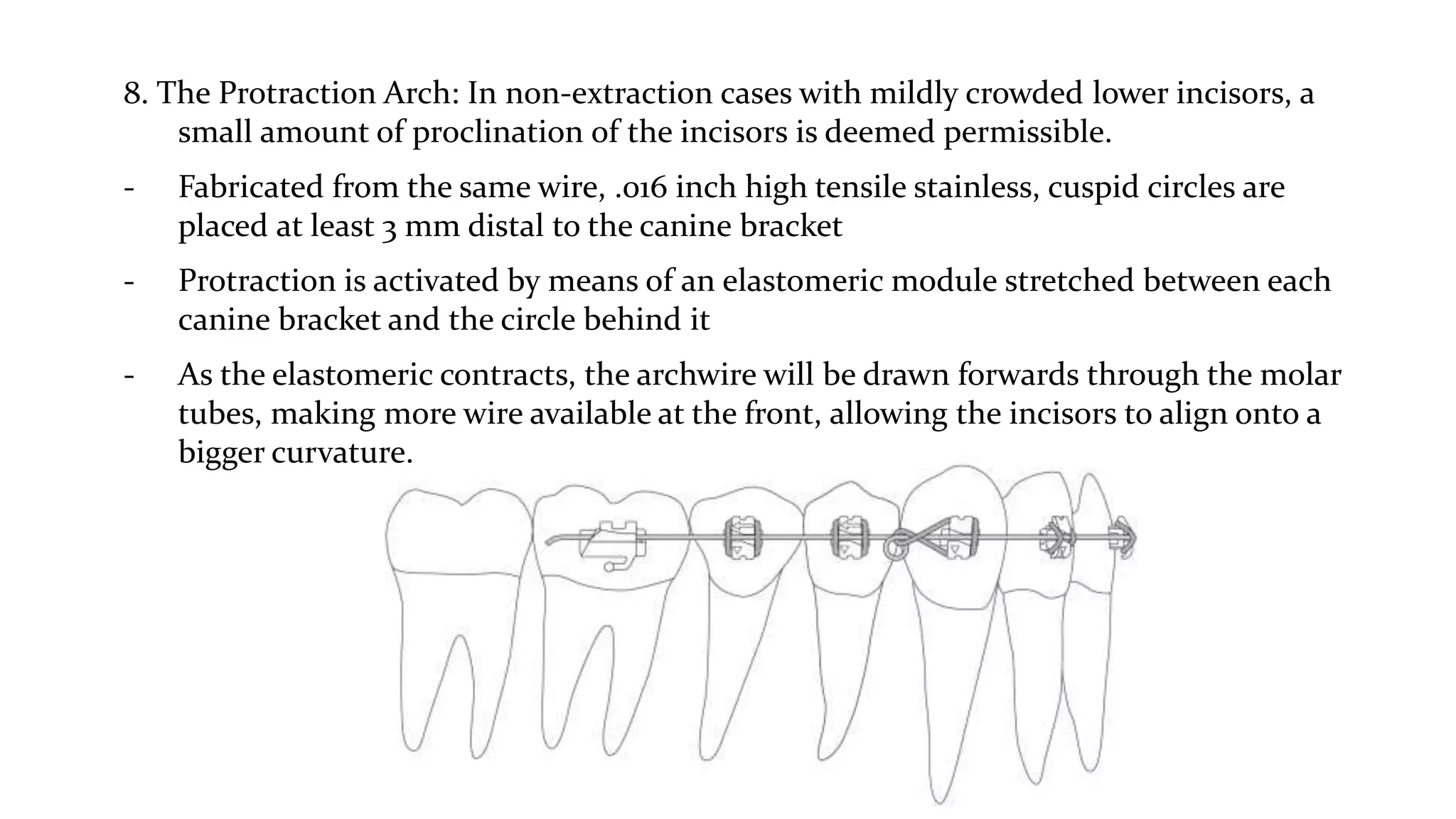 Tip edge mechanics | PPTX