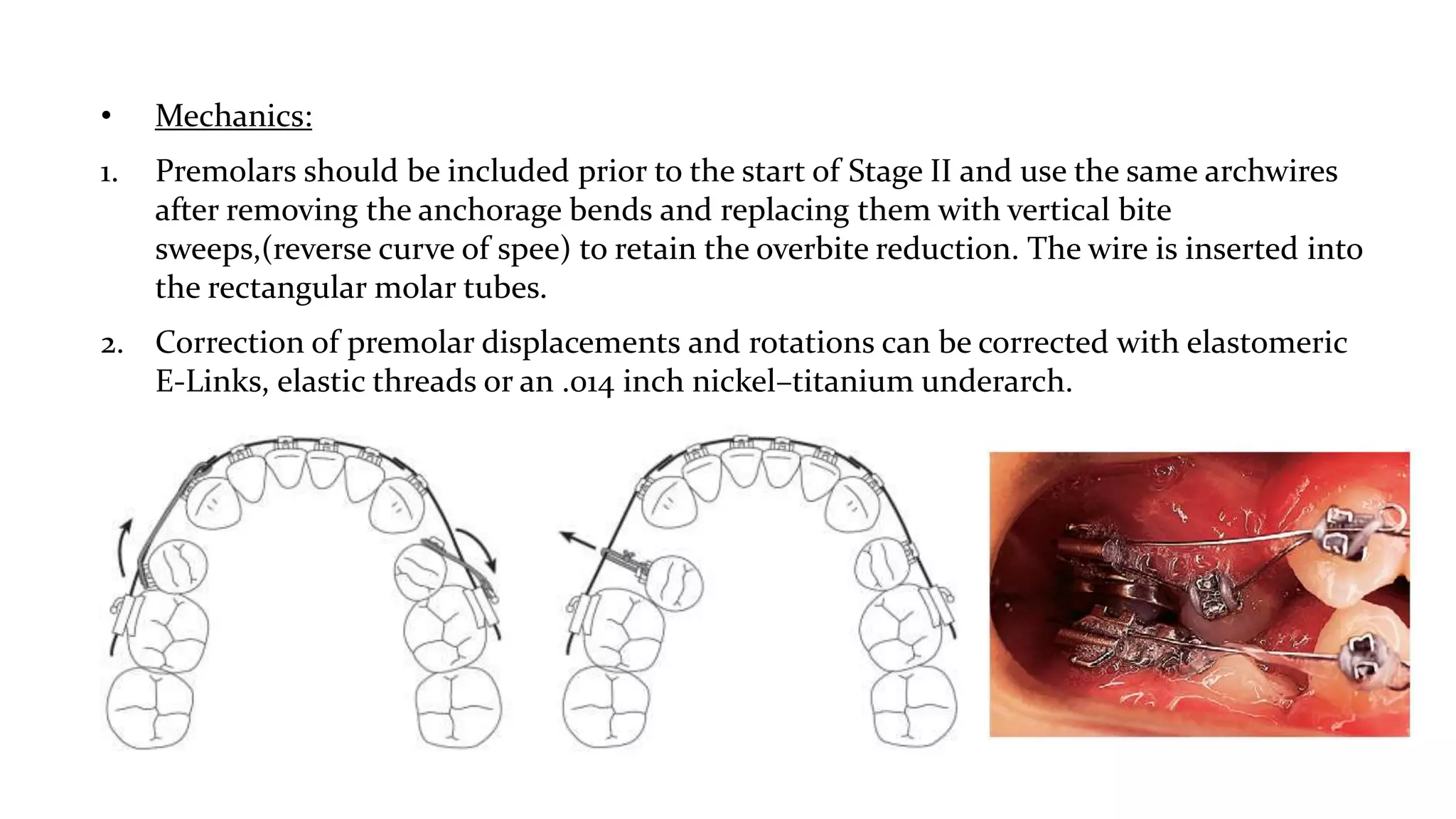Tip edge mechanics | PPTX
