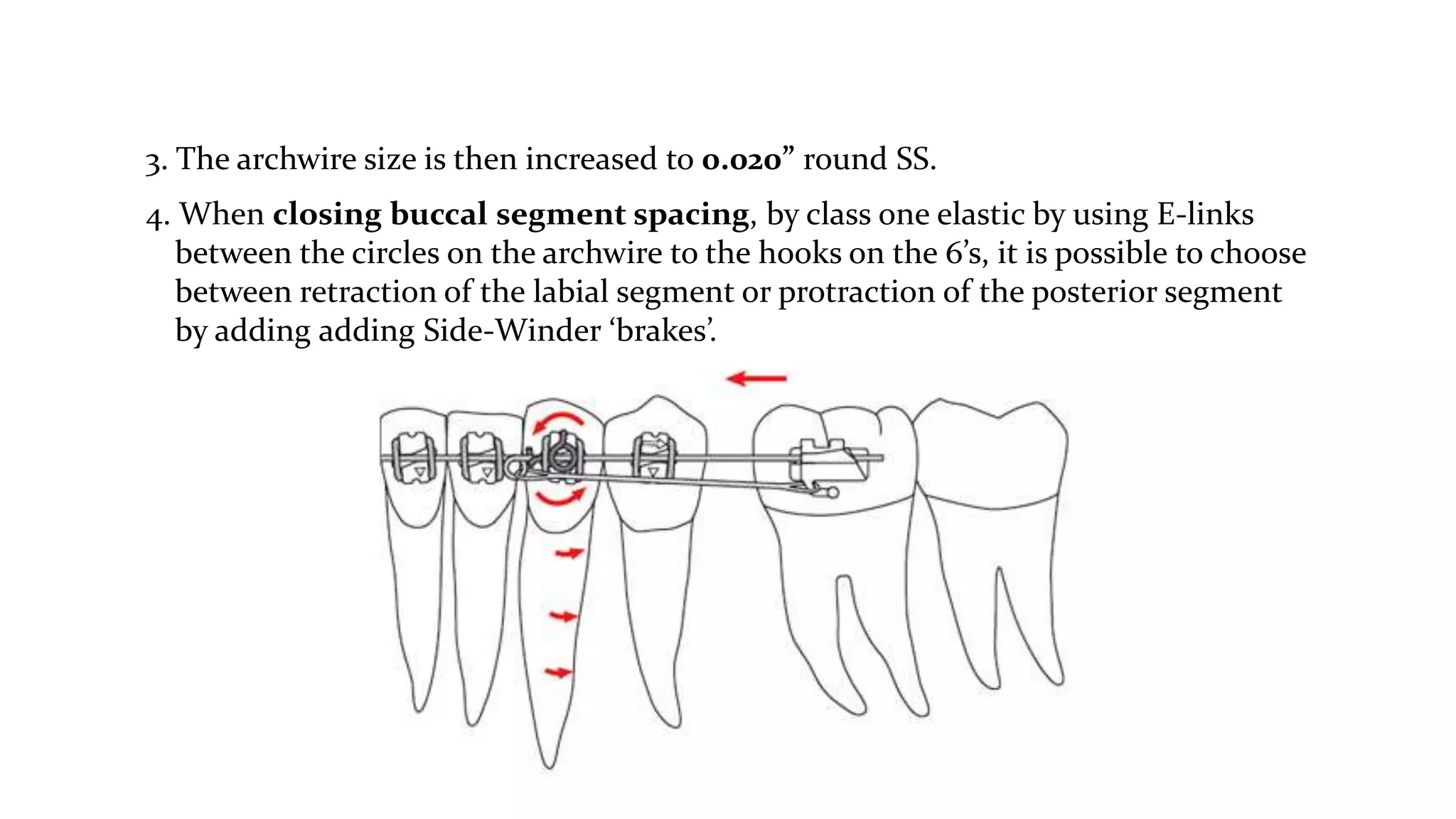 Tip edge mechanics | PPTX