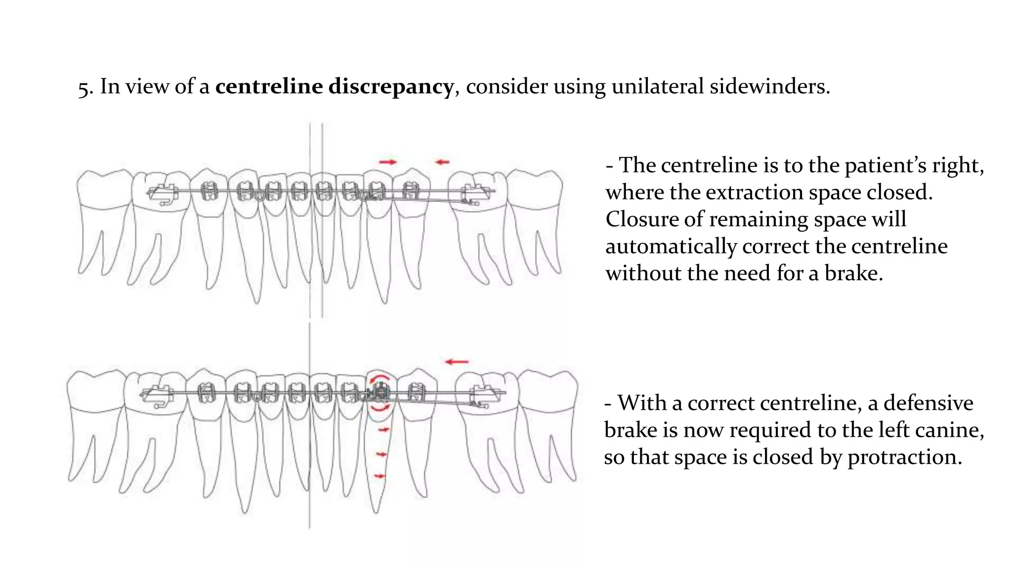 Tip edge mechanics | PPTX