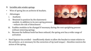 Tip edge mechanics | PPTX
